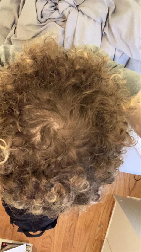 Am I Balding R Malehairadvice