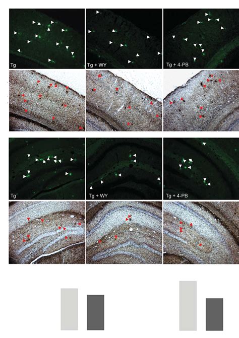 Wy And 4 Pb Reduce The Percentage Of Ths Positive Amyloid Plaques With