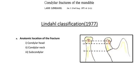 Condylar Fracturepptx