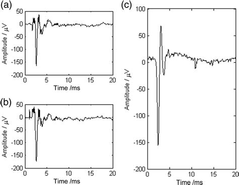 The Acoustically And Optically Evoked Compound Action Potentials A Download Scientific