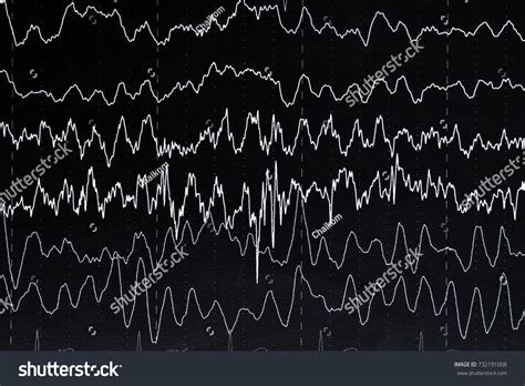 Eeg Electroencephalogramp Monitoring Method Eeg Wave Stock Photo 732191008 Shutterstock