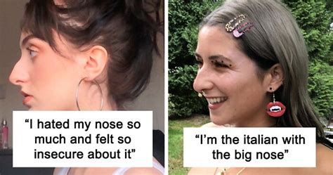 Women Are Posting Their Noses That Look Like Before” Photos 30 New