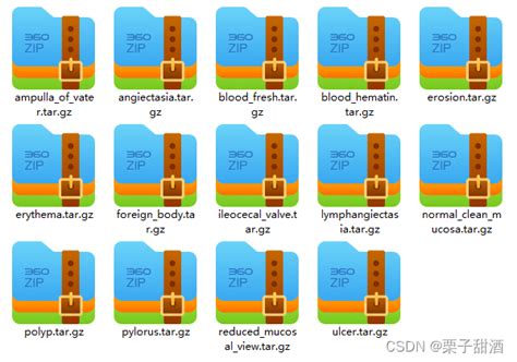 关于hyper Kvasir、kvasir Capsule和kvasir V2数据集hyper Kvasir Csdn博客