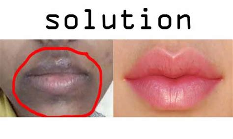 Why My Lips Get Black Spots Lipstutorial Org