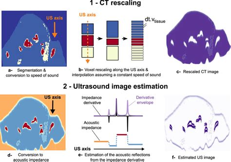 Workflow Used To Estimate The Ultrasound Images From The X Ray CBCT