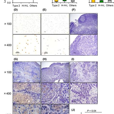 Comparison Of Clinical Features Of Japanese Npc Categorized Using Ebv Download Scientific