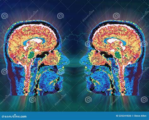 Neuroimaging Or Brain Imaging Stock Illustration Illustration Of