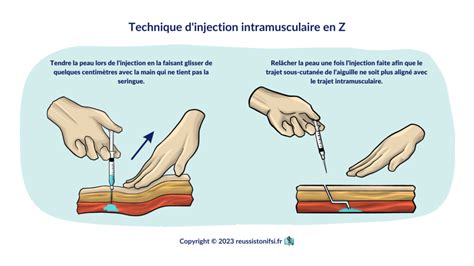 Fuite sous cutanée après injections MESO Rx Français