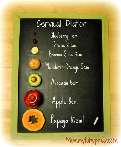 Cervix Dilation Chart Labor