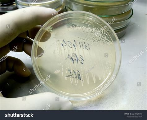 Staphylococcus Aureus Grampositive Gramvariable Nonmotile Coccusbeta