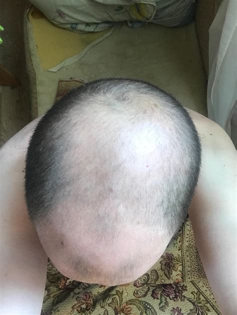Trainingdatapro Bald Classification · Datasets At Hugging Face