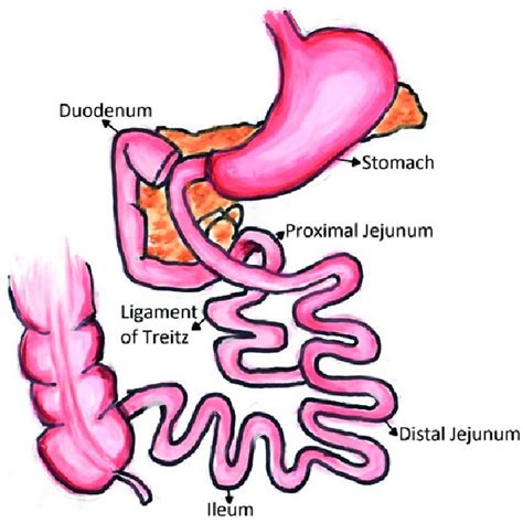 Duodenal Jejunal Bypass Download Scientific Diagram