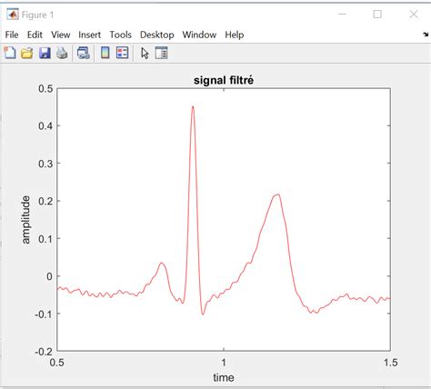 GitHub AMRANINEJJARTasnime TP3 Traitement D Un Signal ECG