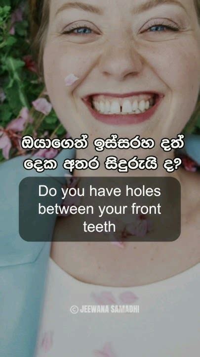ඔයාගෙත් ඉස්සරහ දත් දෙක අතර සිදුරුයිද Youtube