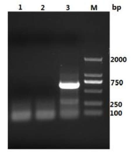 The Test Result By Multiplex RT PCR Line 1 And Line 2 Were Two