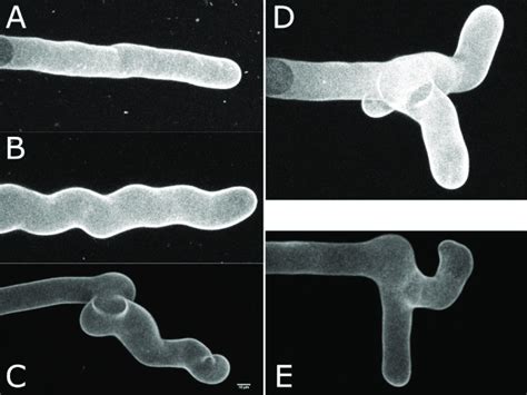 Rhizoid Cells Treated With The Microtubule Destabilizing Drug Oryzalin