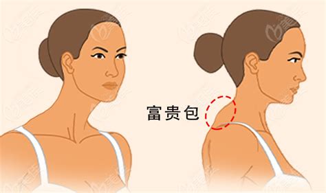 黄学峰一针祛富贵包总店在哪里？北京，且广州杭州郑州有分院最热整形行业新闻话题 美佳网