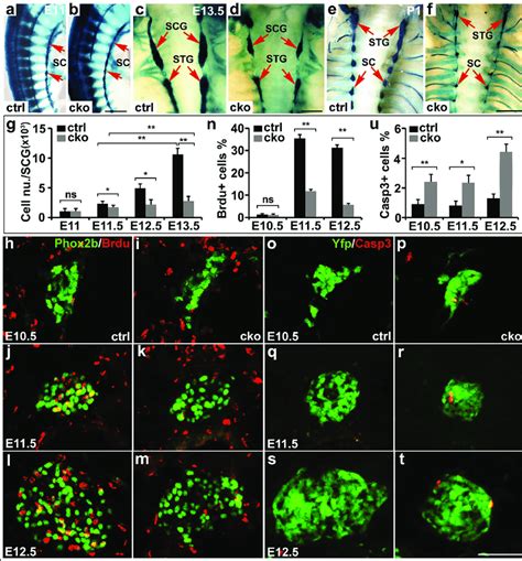 Neural Crest Specific Ablation Of Isl1 Leads To Loss Of Sympathetic