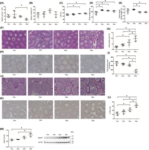 Keap1 Nrf2 System Regulates Age‐related Spermatogenesis Dysfunction Pmc