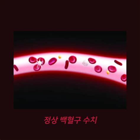 백혈구 수치 낮으면 감소증 원인 높이려면 어떻게 네이버 블로그