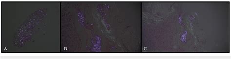 Surgical Specimens Of The Thoracic Spine Subjected To Polarized Light