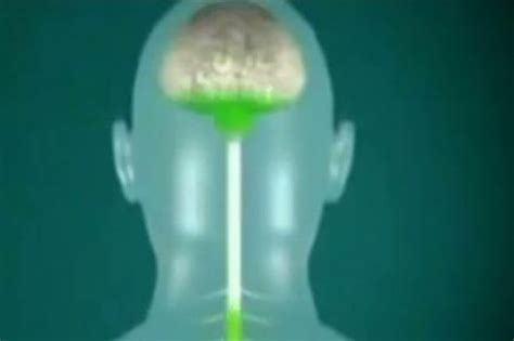 ¿qué Es La Esclerosis Amiotrófica Lateral Enfermedad Que Da Origen Al