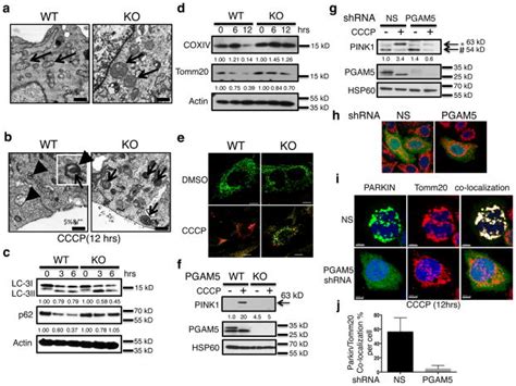 Genetic Deficiency Of The Mitochondrial Protein Pgam5 Causes A