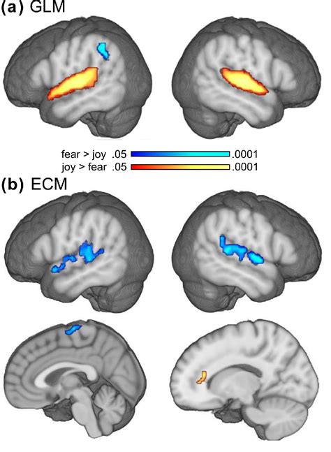 Figure 1 From The Auditory Cortex Hosts Network Nodes Influential For Emotion Processing An