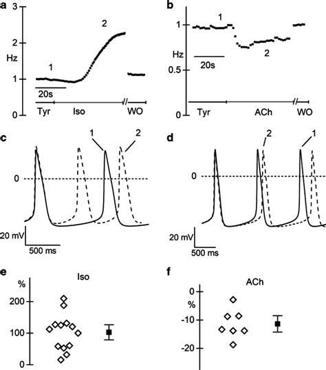 A Detailed Characterization Of The Hyperpolarization Activated Funny Current If In Human