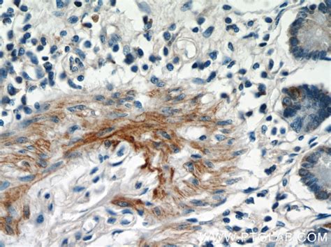 Osteocalcin OCN Antibody 23418 1 AP Proteintech