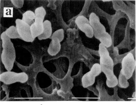 Figure 1 From Xanthobacter Tagetidis Sp Nov An Organism Associated With Tagetes Species And