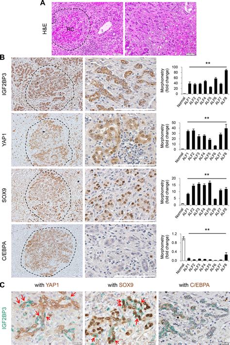 Hepatocytes Expressing Igf2bp3 And Other Fetal Liver Cell Markers