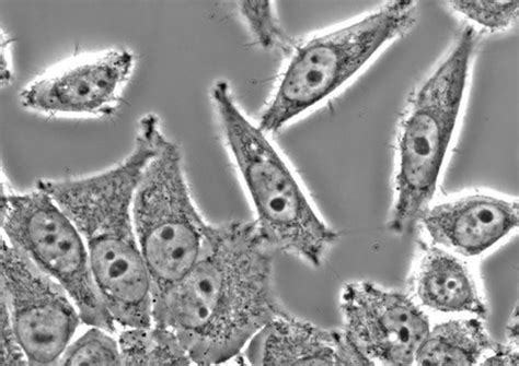 L15 Fluorescence Microscopy Flashcards Quizlet