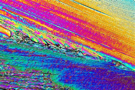 Urea Crystals Light Micrograph Stock Image C062 5028 Science Photo Library