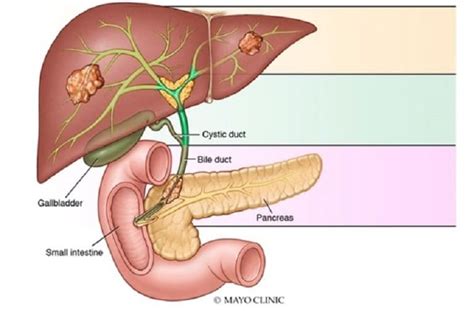 Scientific And Clinical Advances Aid In Diagnosis Staging And