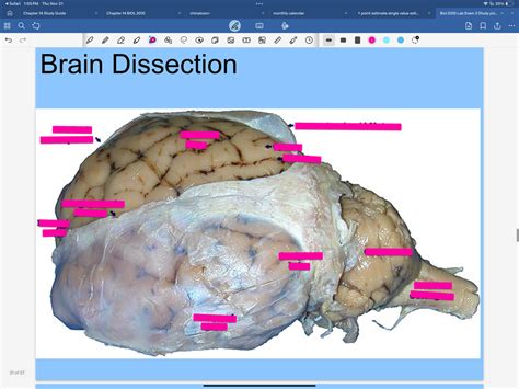 Brain Dissection Diagram Quizlet