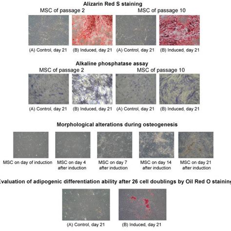 Upper Panel Osteogenic Differentiation Of Msc After Passage 2 A B