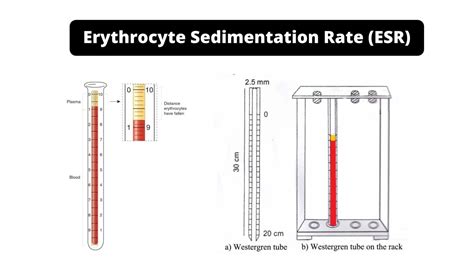 Stokes Disc Diffusion Method Principle Procedure Result Biology Notes Online