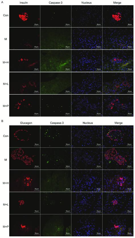 Paos Improved Islet β Cell Function And Downregulated Its Apoptosis In