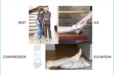 Acute Injuries Rice Verses Meth Sports Medicine Review