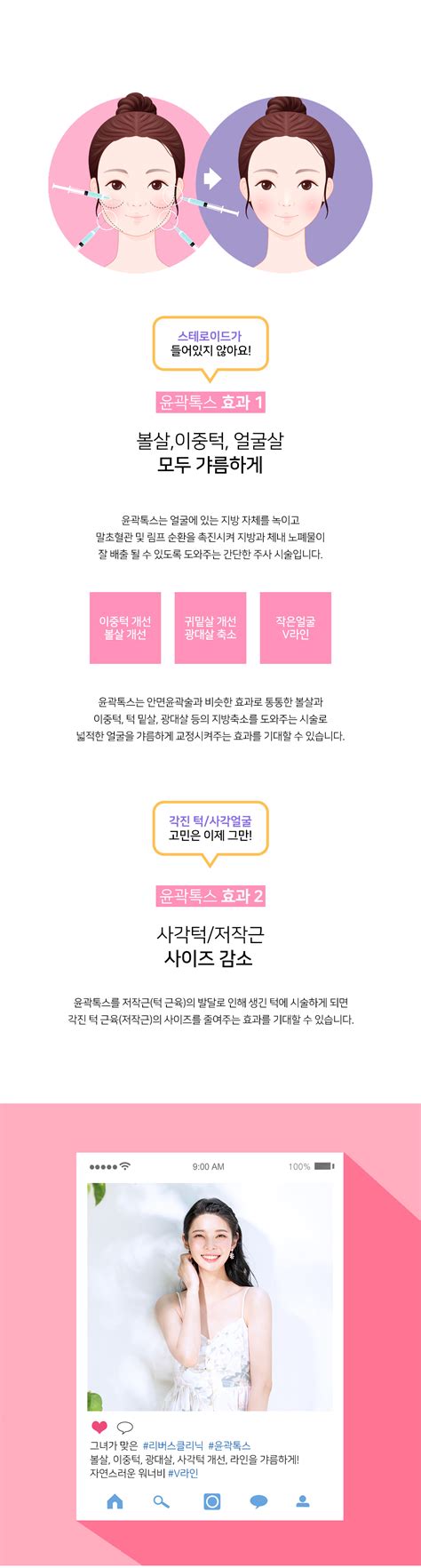 이중턱볼살각진턱 갸름하게 By 리버스클리닉 명동 강남언니 1등 성형수술and피부시술 정보앱