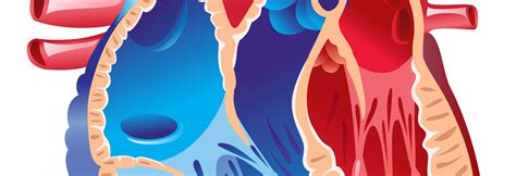 Arterial Shunt For Pah Receives Fdas Breakthrough Device Designation