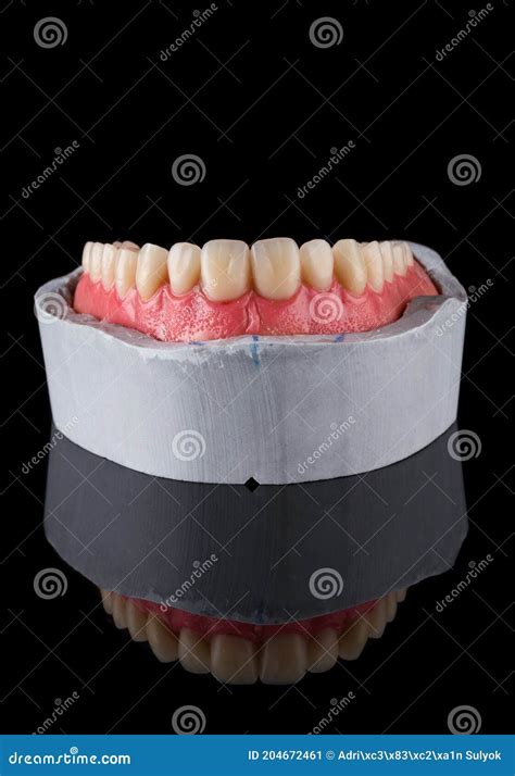 Complete Maxillary Denture Royalty Free Stock Image