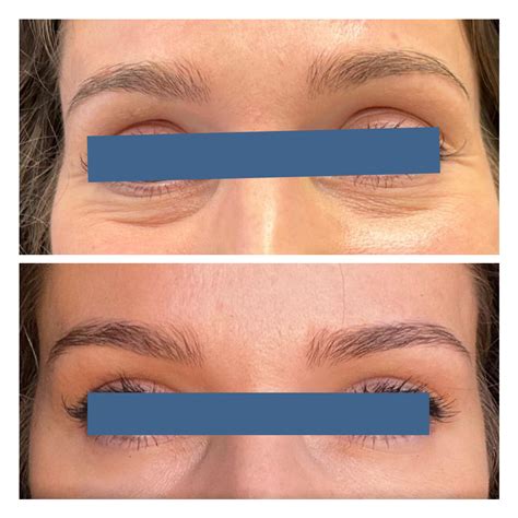 Gallery 2 Doctor Ariel Romeo