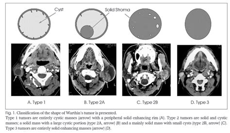 Classification Of The Shape Of Radiology Archive