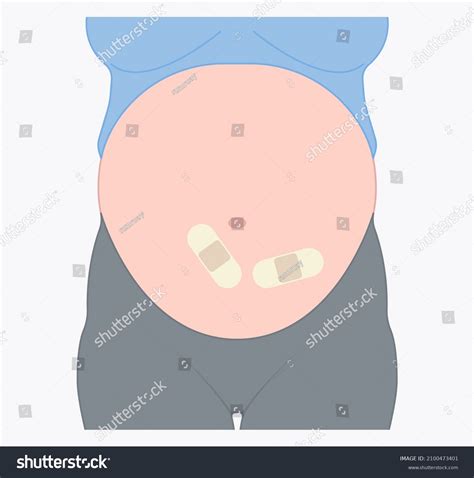 Amniocentesis Diagnostic Test Treat Lab Analysis Stock Vector Royalty