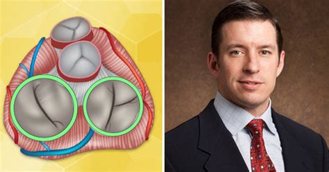 Mitral And Tricuspid Valve Surgery Survival And Durability