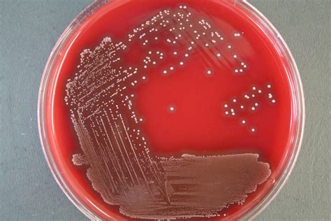 Eqa Schemes Uk Neqas Microbiology