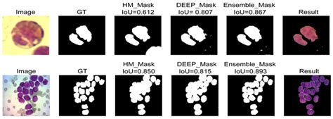 Comparison Between Hm Deep And Ensemble Results Download