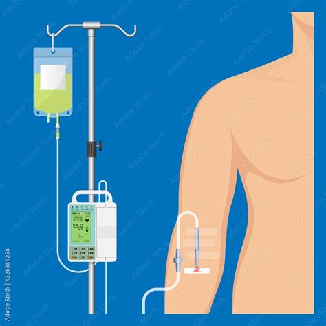 Chemo Iv Infusion Pump At Judy Canup Blog